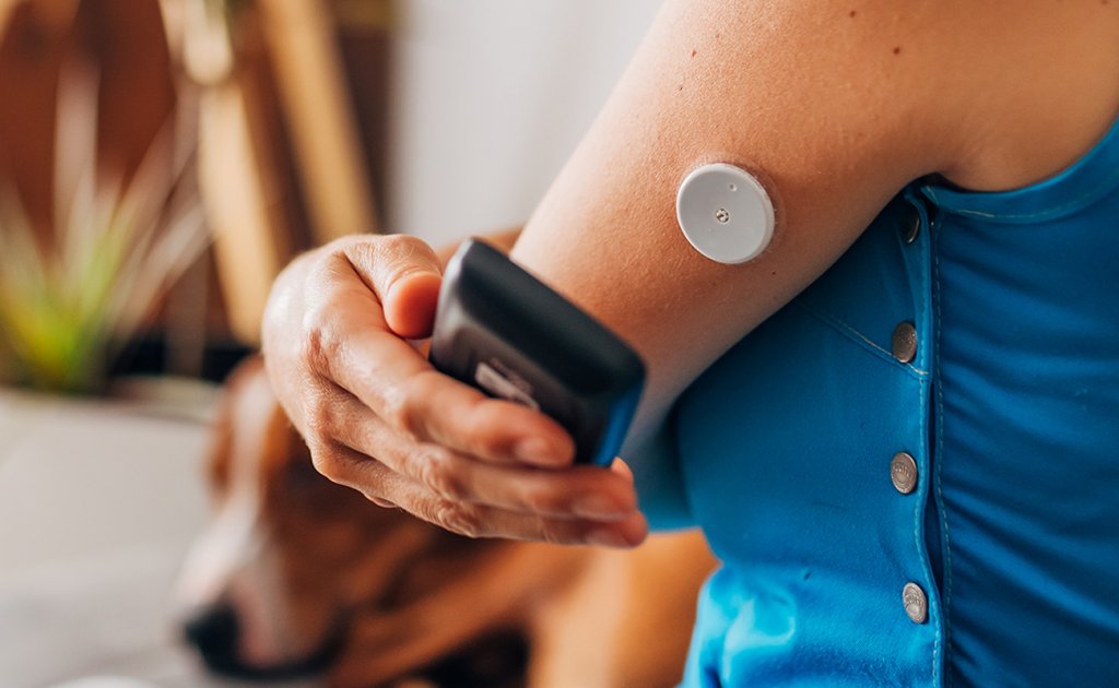 Continuous Glucose Monitor Design | Phillips Medisize